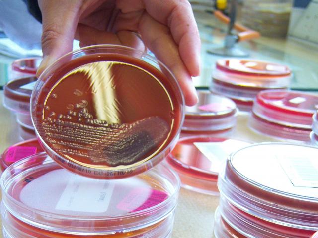 Reverse CAMP test for identification of Clostridium perfringens ...